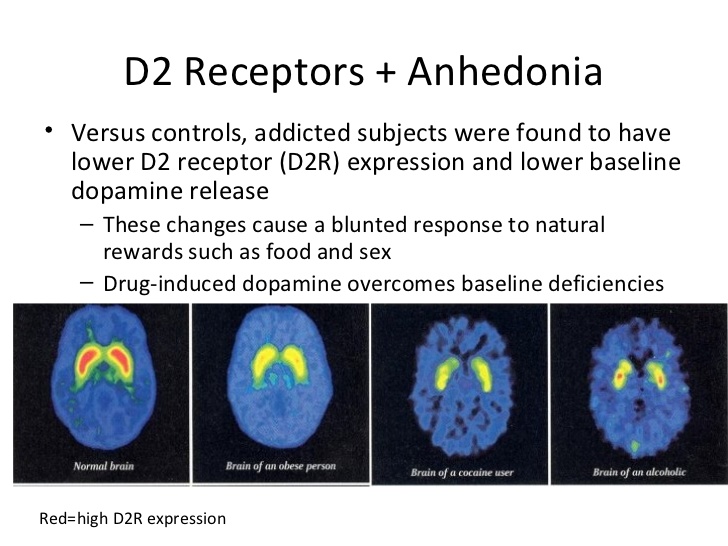 Boost Up Dopamine for Motivation and Focus - DrJockers.com Boost Up Dopamine for Motivation and Focus - DrJockers.com