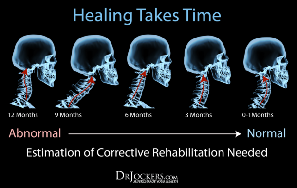 Bad Posture Results in Bad Overall Health - DrJockers.com