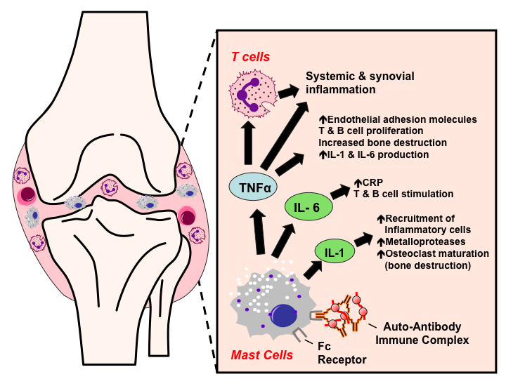 20 Ways to Beat Rheumatoid Arthritis Naturally