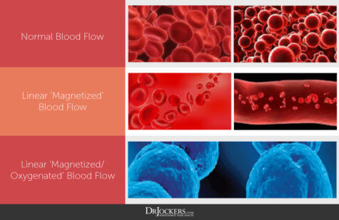 The Health Benefits of Bio Magnetic Therapy - DrJockers.com