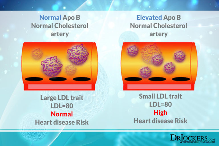 The NMR and Your Heart Disease Risk - DrJockers.com