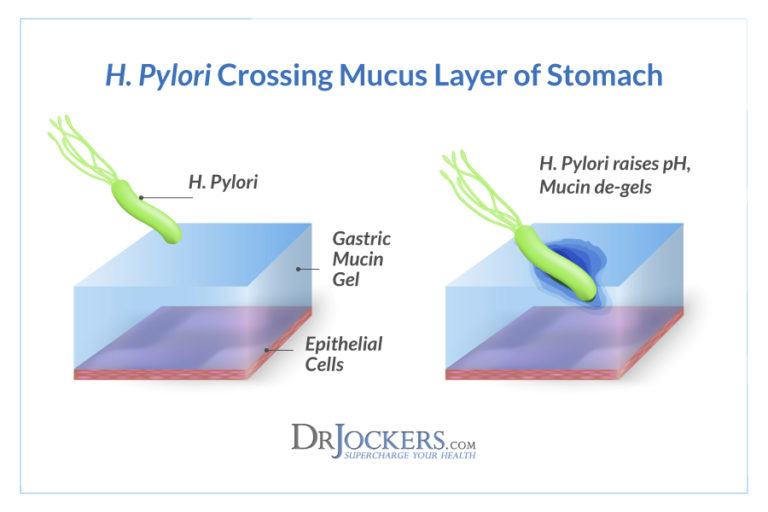 H Pylori Testing - DrJockers.com