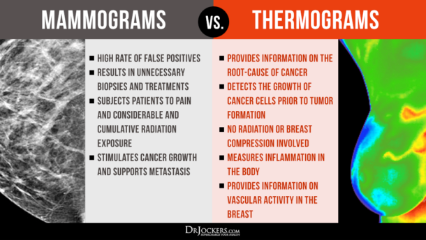 Mammograms and Your Risk of Cancer - DrJockers.com