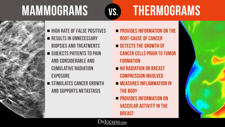 Mammograms and Your Risk of Cancer - DrJockers.com
