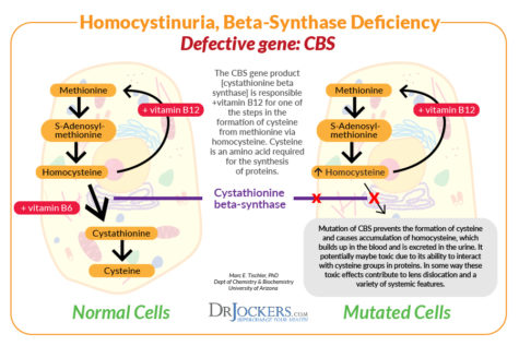 CBS Mutation and Low Sulfur Diet - DrJockers.com