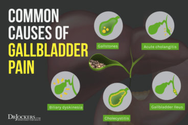 How to Beat GallStones Naturally - DrJockers.com
