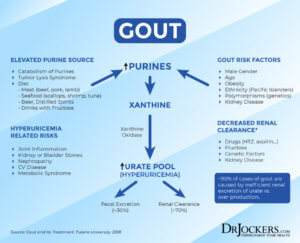 Gout: Symptoms, Causes and Natural Support Strategies