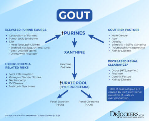Gout: Symptoms, Causes and Natural Support Strategies