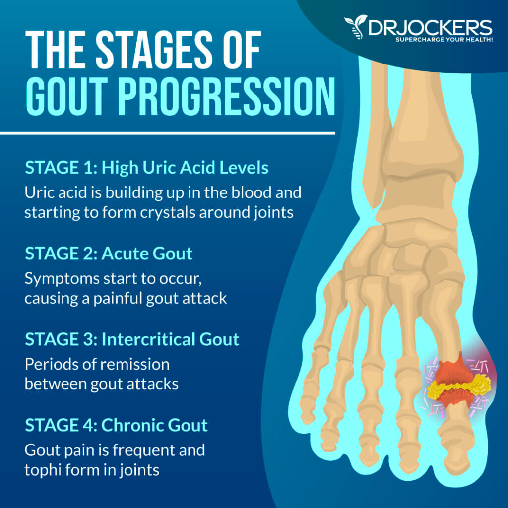 Uric Acid: A Key Player in Cardio, Brain, and Metabolic Diseases