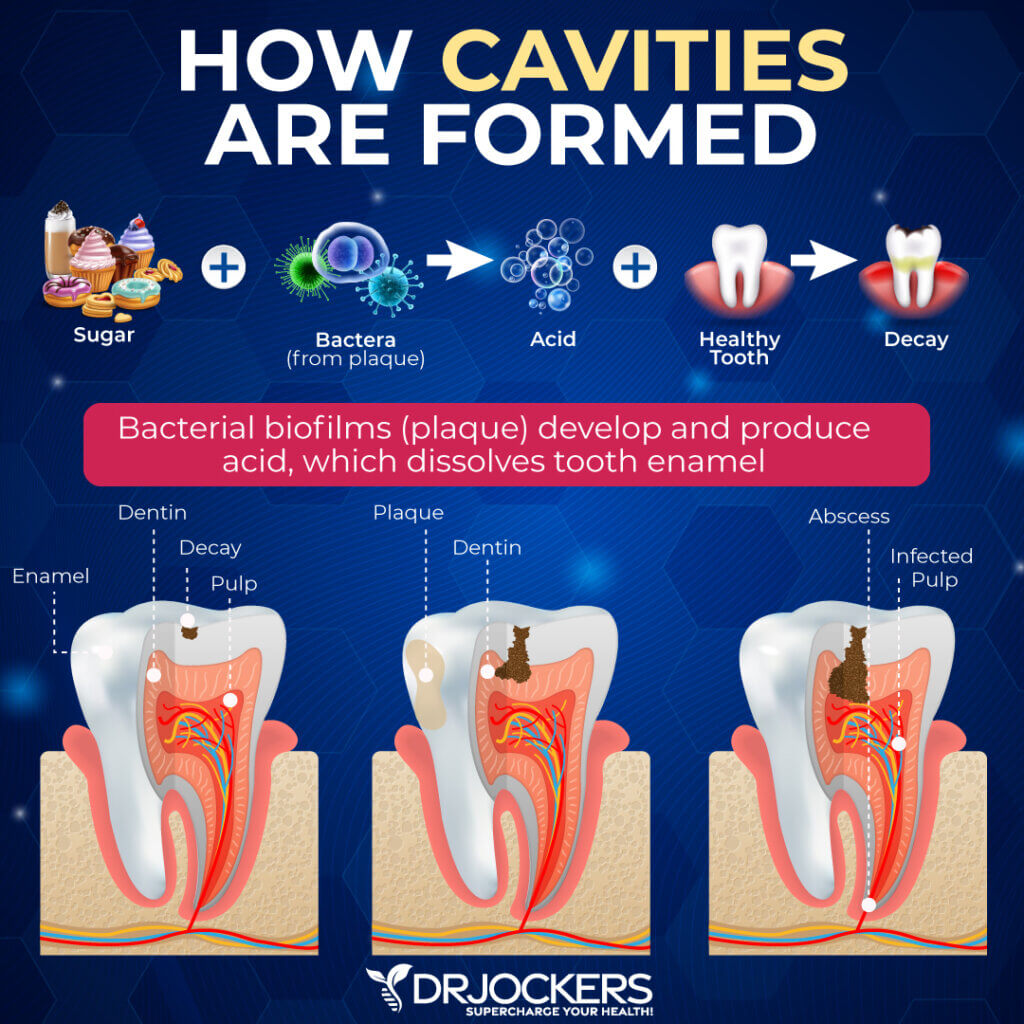 Cavities: Symptoms, Causes and Support Strategies