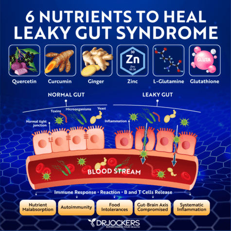 6 Nutrients That Heal Leaky Gut Syndrome - DrJockers.com