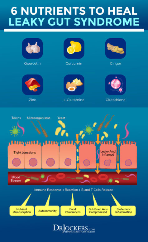 6 Nutrients That Heal Leaky Gut Syndrome - DrJockers.com