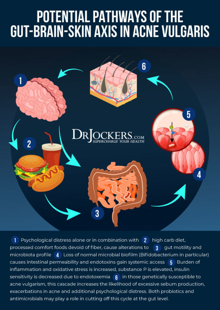 10 Things Acne Means About Your Health - DrJockers.com