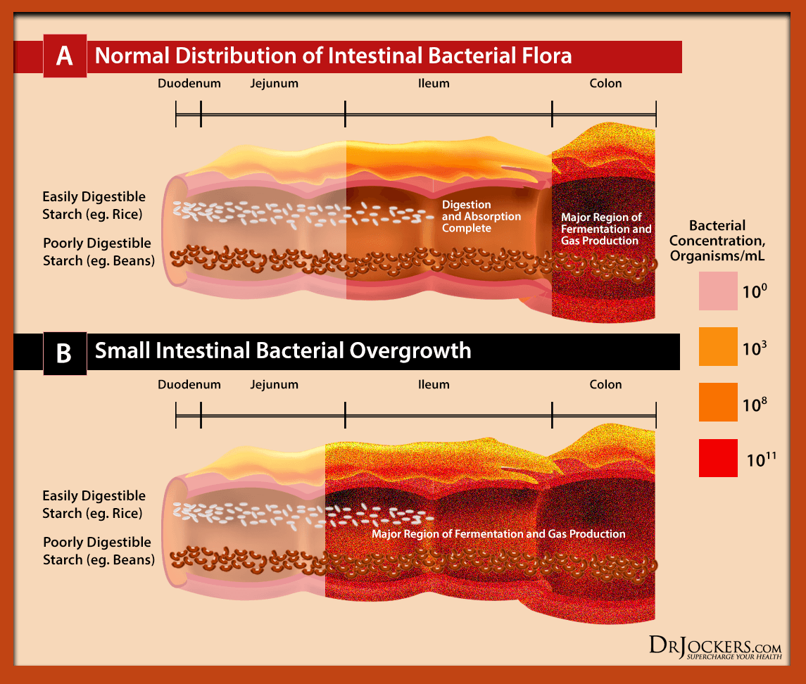 12 Ways to Overcome Constipation - DrJockers.com
