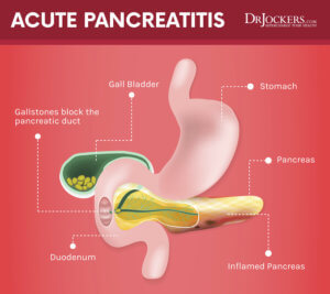Pancreatitis: Symptoms, Causes and Natural Support Strategies
