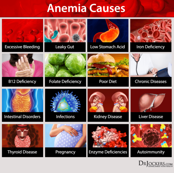 Anemia: Causes, Symptoms and Support Strategies - DrJockers.com