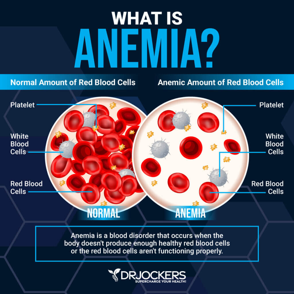 Anemia: Causes, Symptoms and Support Strategies - DrJockers.com