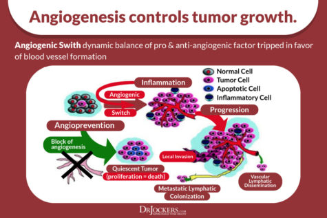 How Does Metastatic Cancer Form in The Body? - DrJockers.com