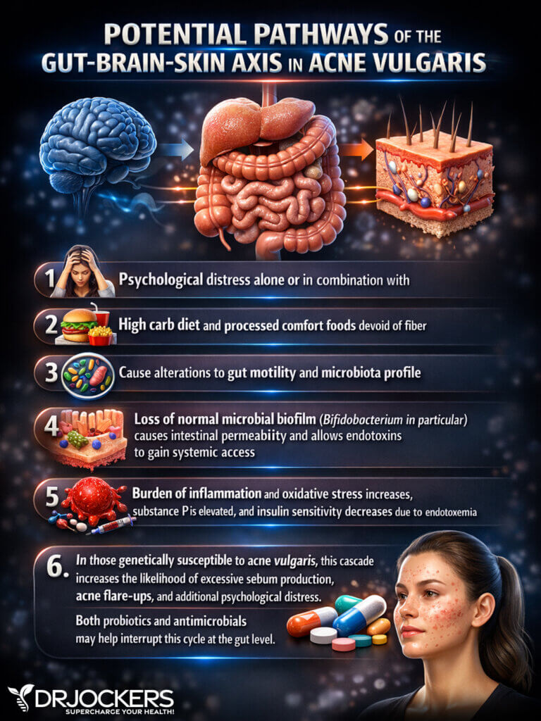 10 Things Acne Means About Your Health - DrJockers.com