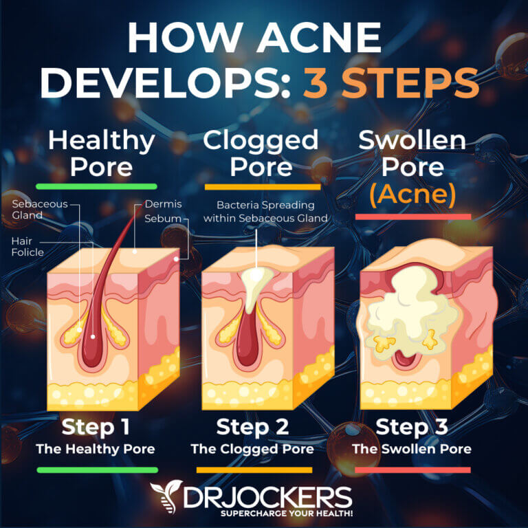 Skin Inflammation: Symptoms, Causes and Support Strategies