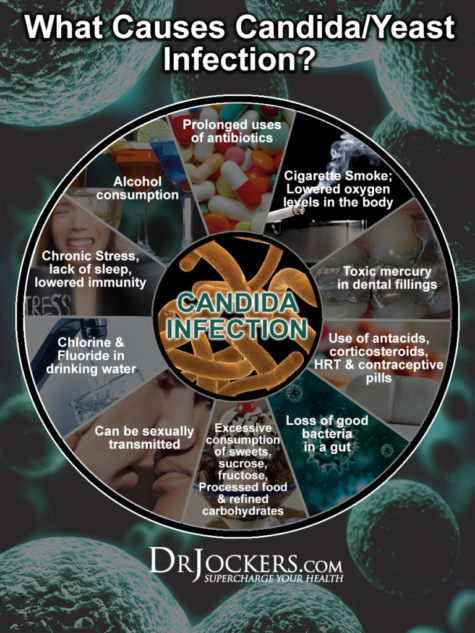 Candida Albicans: Top 10 Herbs and Supplements to Beat It