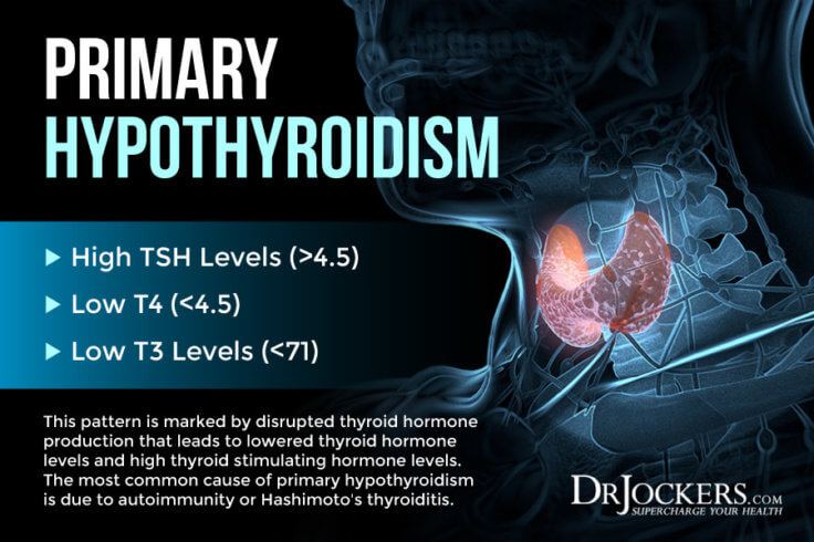 How to Properly Test Thyroid Function with Labs - DrJockers.com