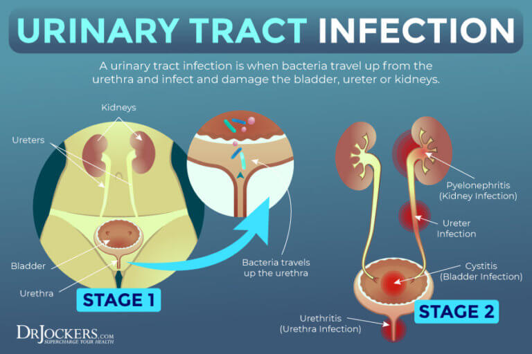 5 Phases to Support Urinary Health Naturally - DrJockers.com