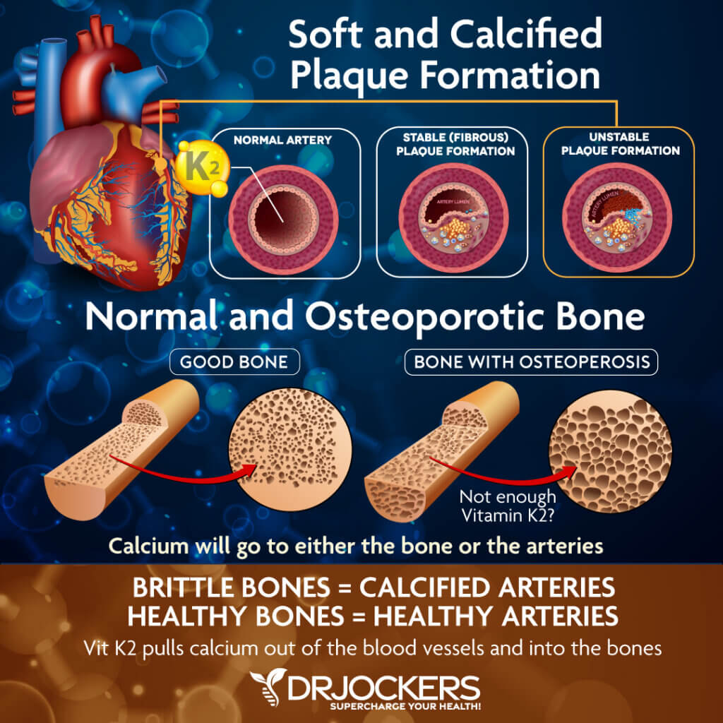 Vitamin K2: Benefits for Heart, Bones, Hormones and More