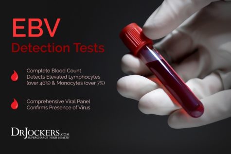 Epstein Barr Virus: Symptoms, Causes and Support Strategies