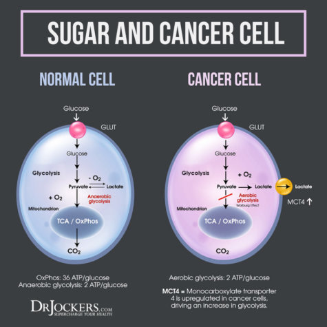 How Sugar Feeds Cancer Growth - DrJockers.com