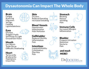 POTS: Causes, Symptoms & Support Strategies - DrJockers.com