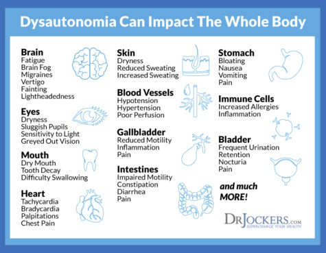 POTS: Causes, Symptoms & Support Strategies - DrJockers.com