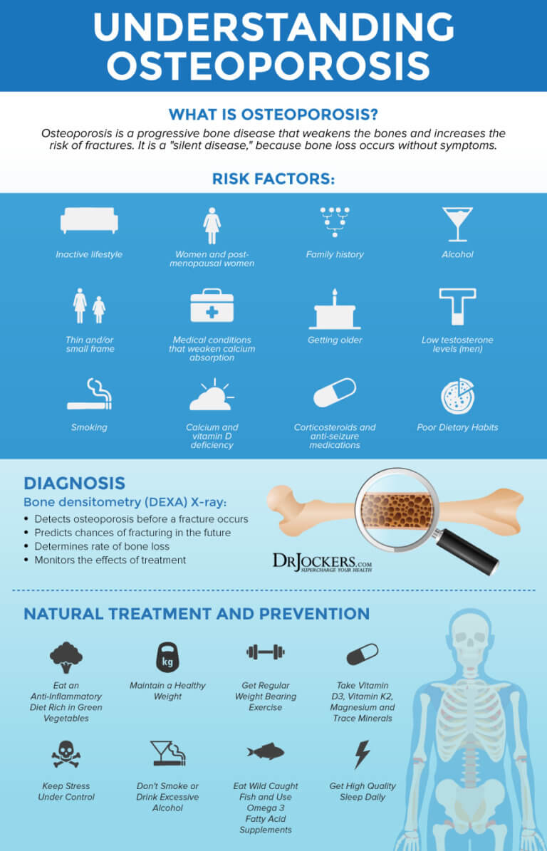 Osteoporosis Symptoms Causes And Natural Support Strategies