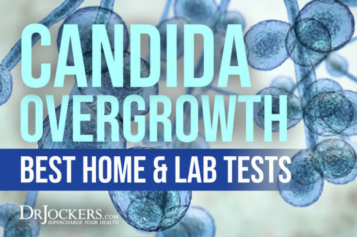 Candida Overgrowth: Best Home & Lab Tests - DrJockers.com