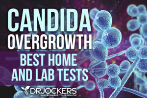 Candida Overgrowth: Best Home & Lab Tests - DrJockers.com