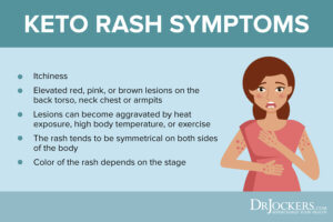 Keto Rash: Causes and Natural Treatments - DrJockers.com