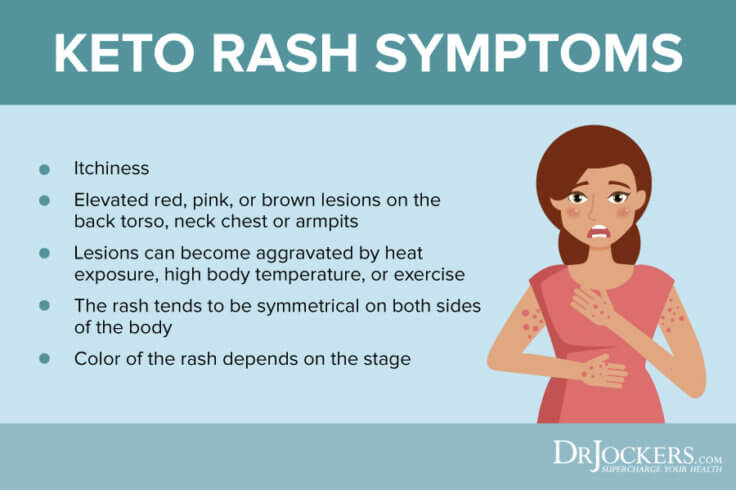 Keto Rash: Causes and Natural Treatments - DrJockers.com