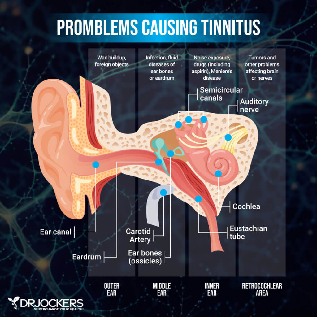 Tinnitus: Symptoms, Causes and Natural Support Strategies