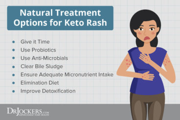 Keto Rash: Causes and Natural Treatments - DrJockers.com