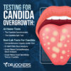 Candida Overgrowth: Best Home & Lab Tests - DrJockers.com