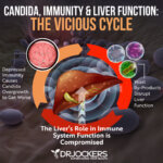 Candida Overgrowth: Best Home & Lab Tests - DrJockers.com