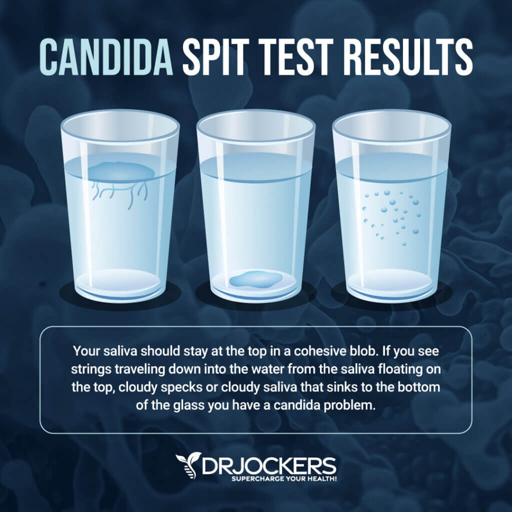 5 Crucial Steps to Heal Candida Naturally - DrJockers.com