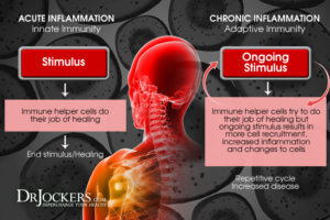Top 7 Strategies to Support Chronic Inflammation - DrJockers.com
