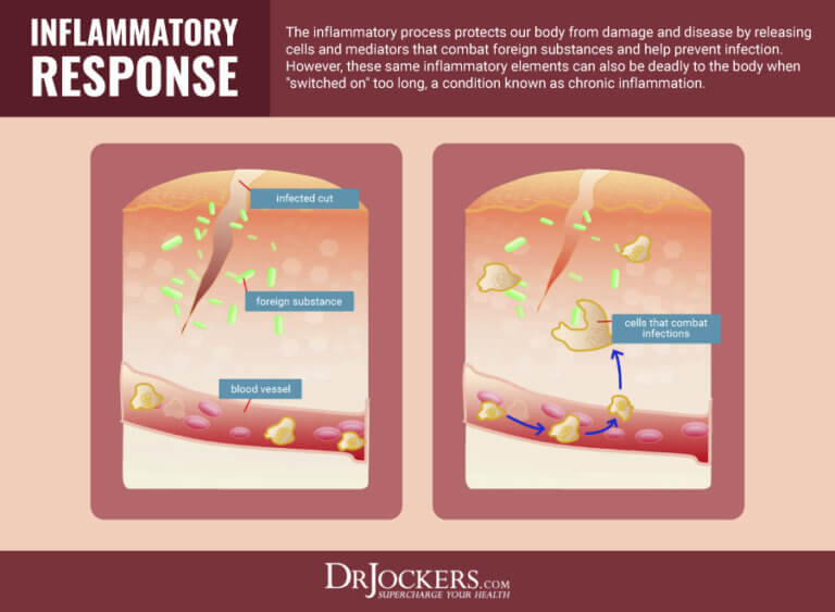 What Causes Inflammation? 7 Key Contributors - DrJockers.com