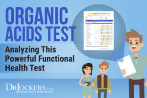 Organic Acids Test: Analyzing this Functional Health Test