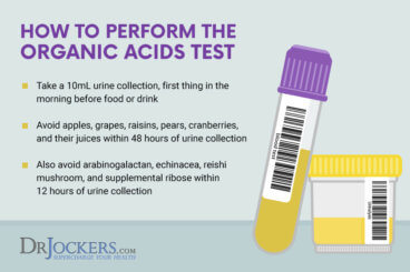 Organic Acids Test: Analyzing this Functional Health Test