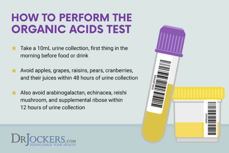Organic Acids Test: Analyzing this Functional Health Test