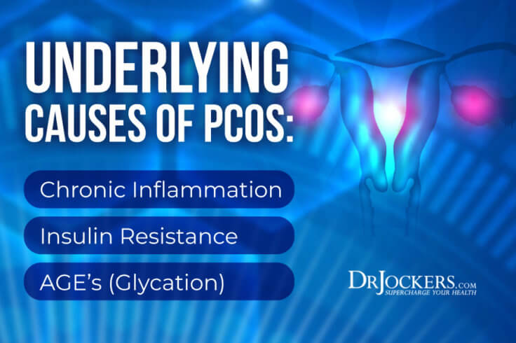 PCOS: Symptoms, Causes and Support Strategies