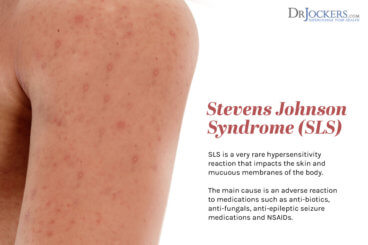 Skin Care Strategies to Heal After Chemotherapy - DrJockers.com