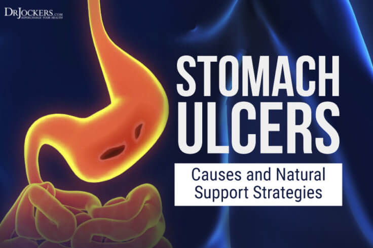 Stomach Ulcers: Causes and Natural Support Strategies - DrJockers.com